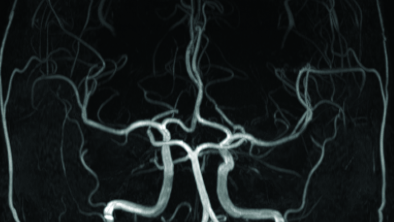 SwiftMR – AIRS Medical Inc.