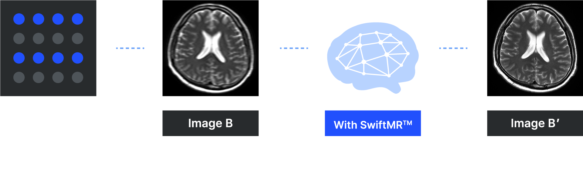 SwiftMR – AIRS Medical Inc.