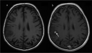 Understanding Brain MRI Images – AIRS Medical Inc.