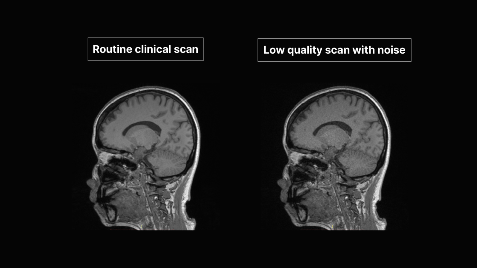 MRI Through the Eyes of Artificial Intelligence: Principles of High ...
