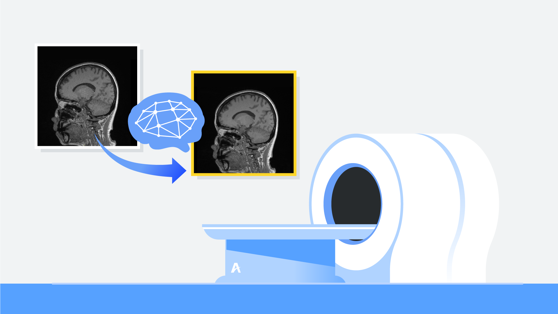 MRI Through the Eyes of Artificial Intelligence: Principles of High-Quality Image Reconstruction ...