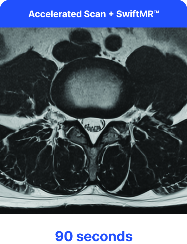 SwiftMR™ Product Information | AI-Powered MRI Enhancement Solution ...