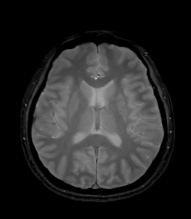 SwiftMR™ Turbo Product Information | AI-Powered MRI Enhancement ...