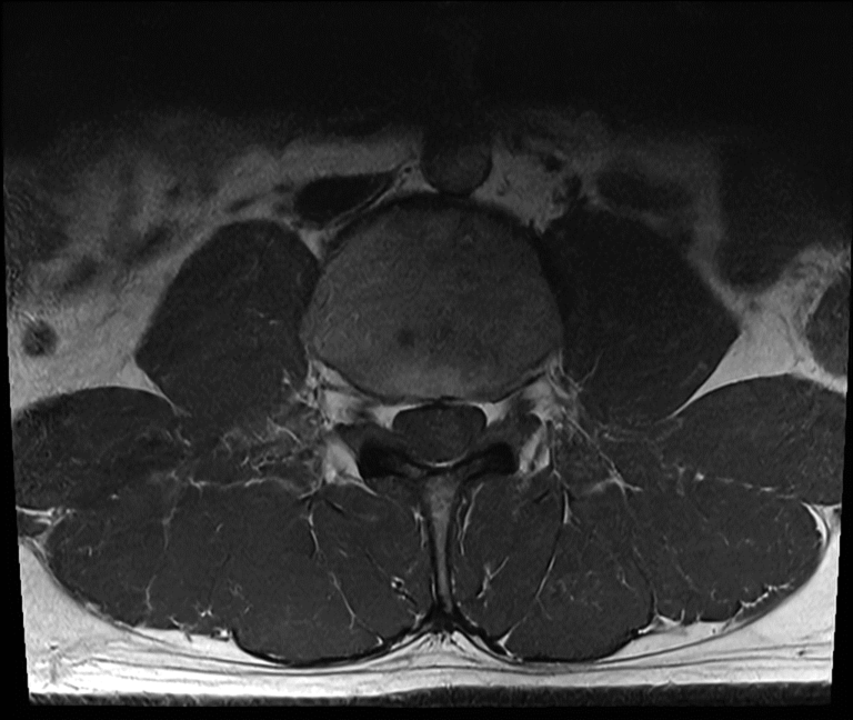 SwiftMR™ Turbo Product Information | AI-Powered MRI Enhancement ...
