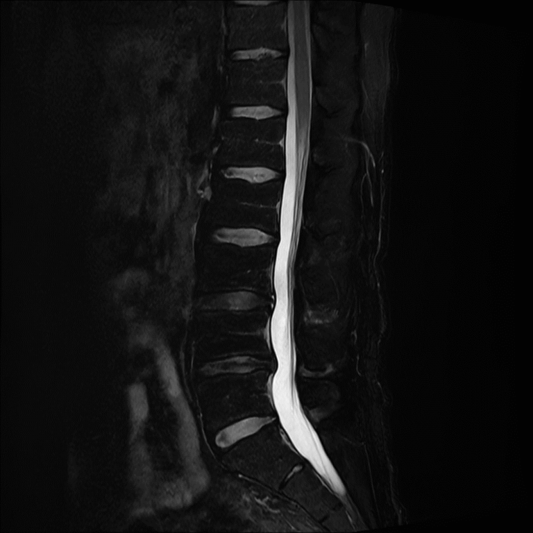 SwiftMR™ Turbo Product Information | AI-Powered MRI Enhancement ...